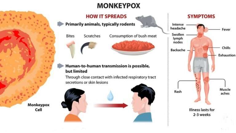 What is Monkeypox? What are the symptoms, and how does it affect you ...